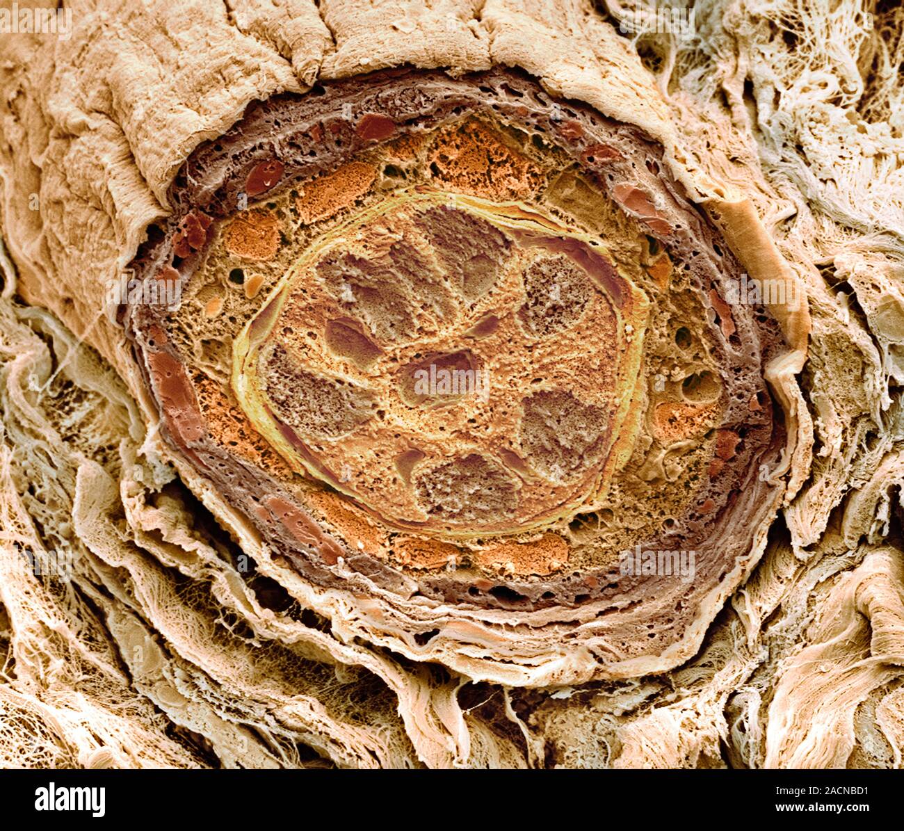 Hair follicle. Coloured scanning electron micrograph (SEM) of a section ...