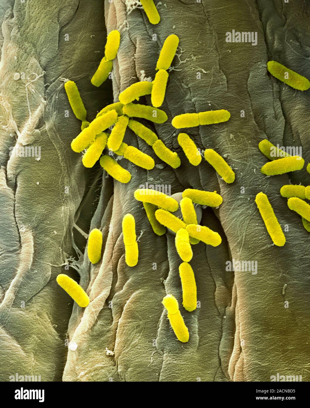 E. coli bacteria. Coloured scanning electron micrograph (SEM) of ...