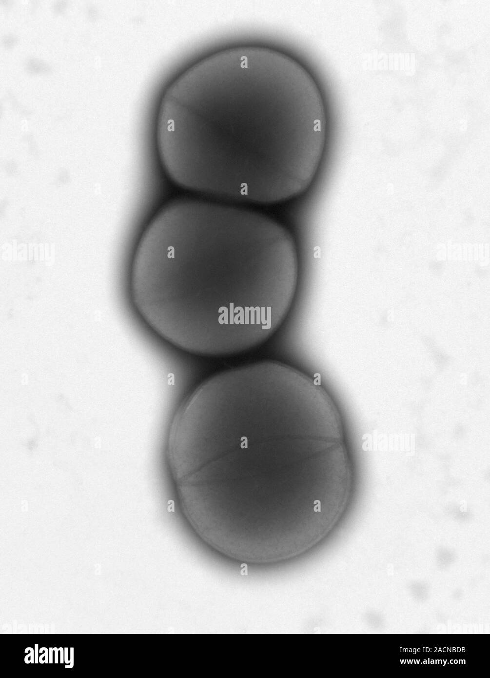 Enterococcus faecalis. Transmission electron micrograph (TEM) of an ...