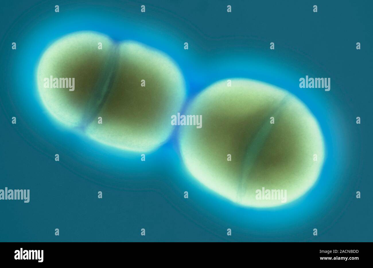 Enterococcus faecalis. Coloured transmission electron micrograph (TEM ...