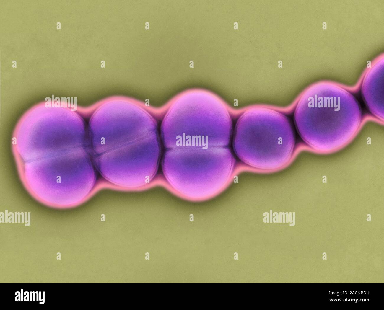 Enterococcus faecalis. Coloured transmission electron micrograph (TEM ...