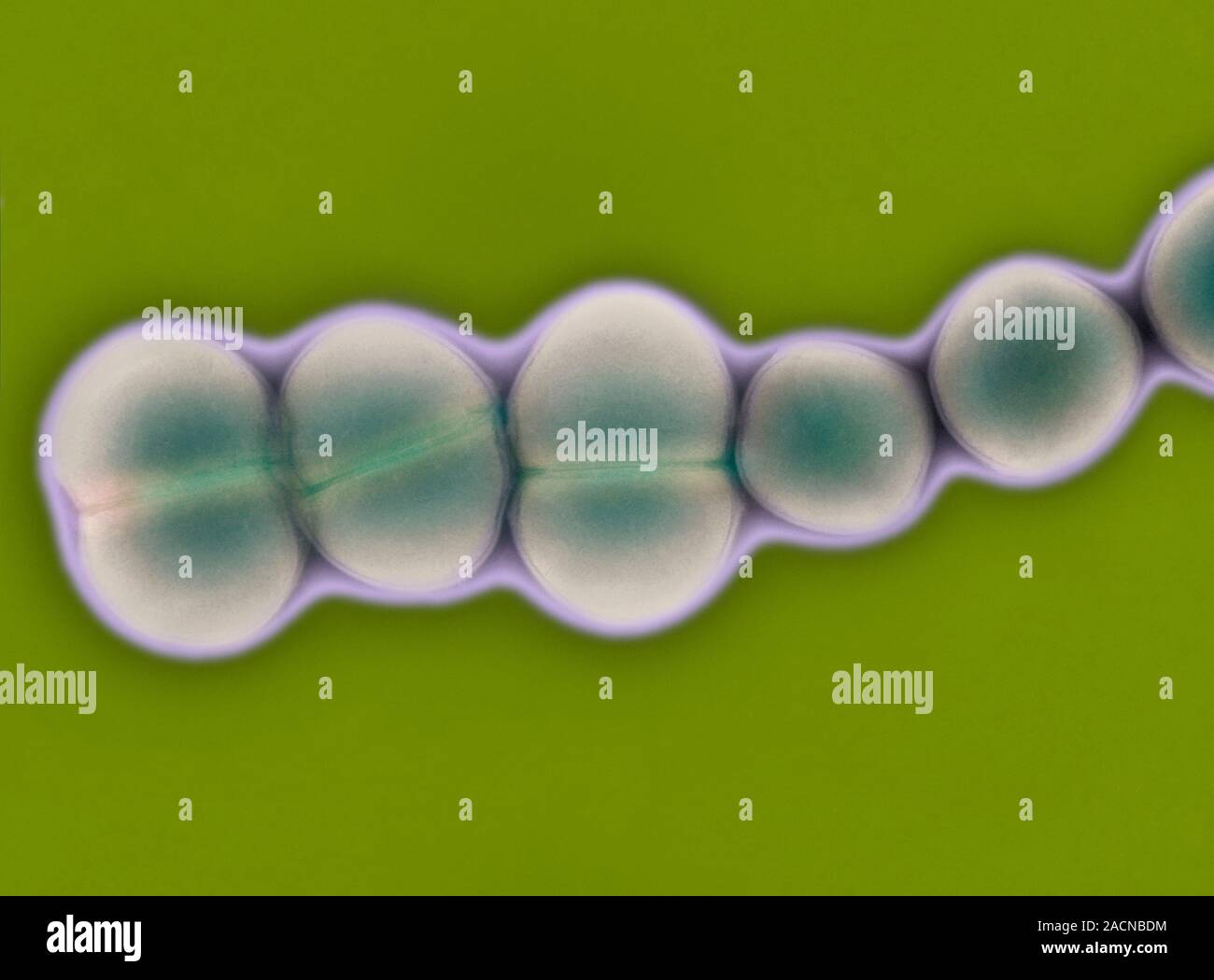 Enterococcus faecalis. Coloured transmission electron micrograph (TEM ...