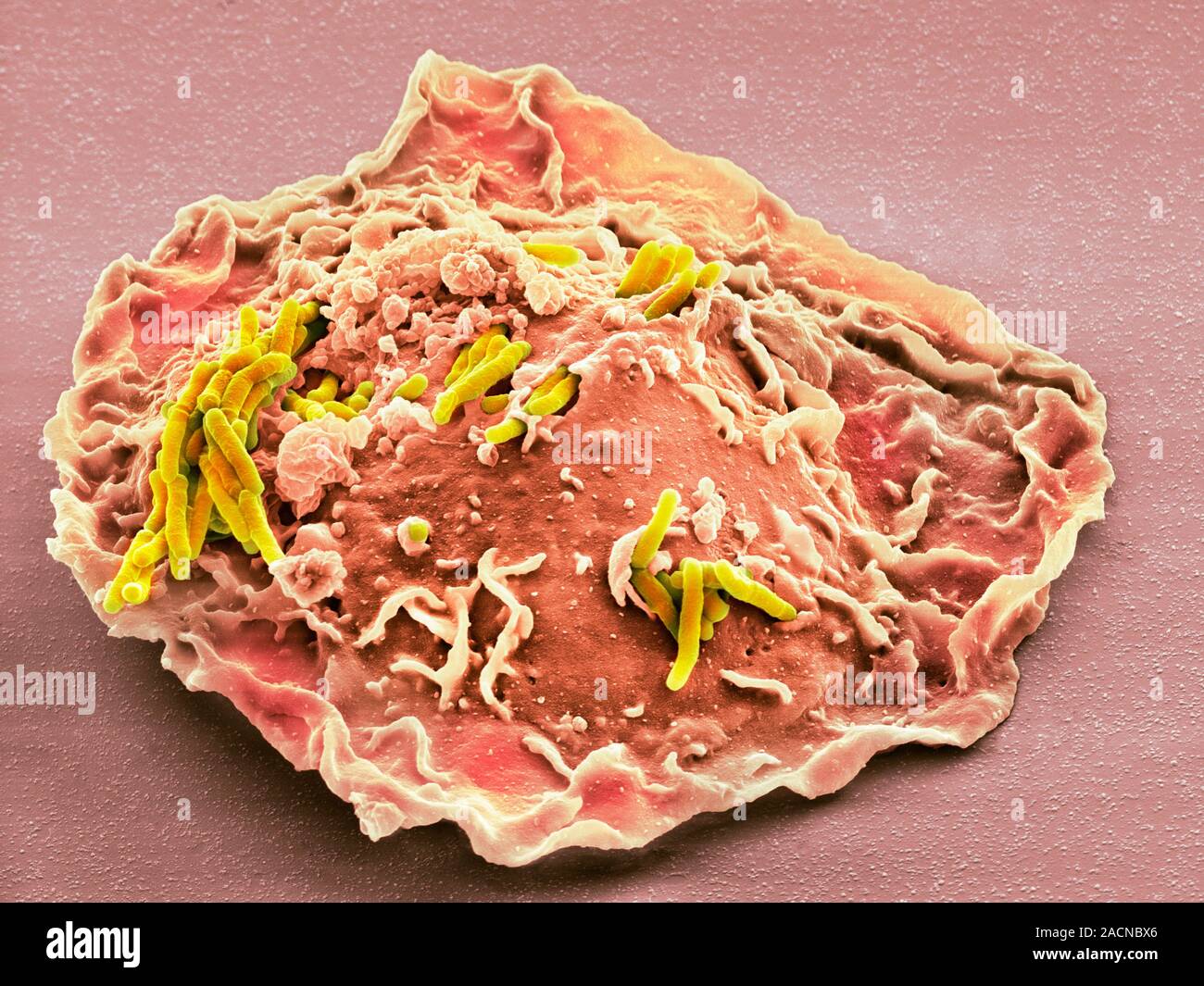 Macrophage engulfing TB bacteria. Coloured scanning electron micrograph ... Macrophage engulfing TB bacteria. Coloured scanning electron micrograph ...