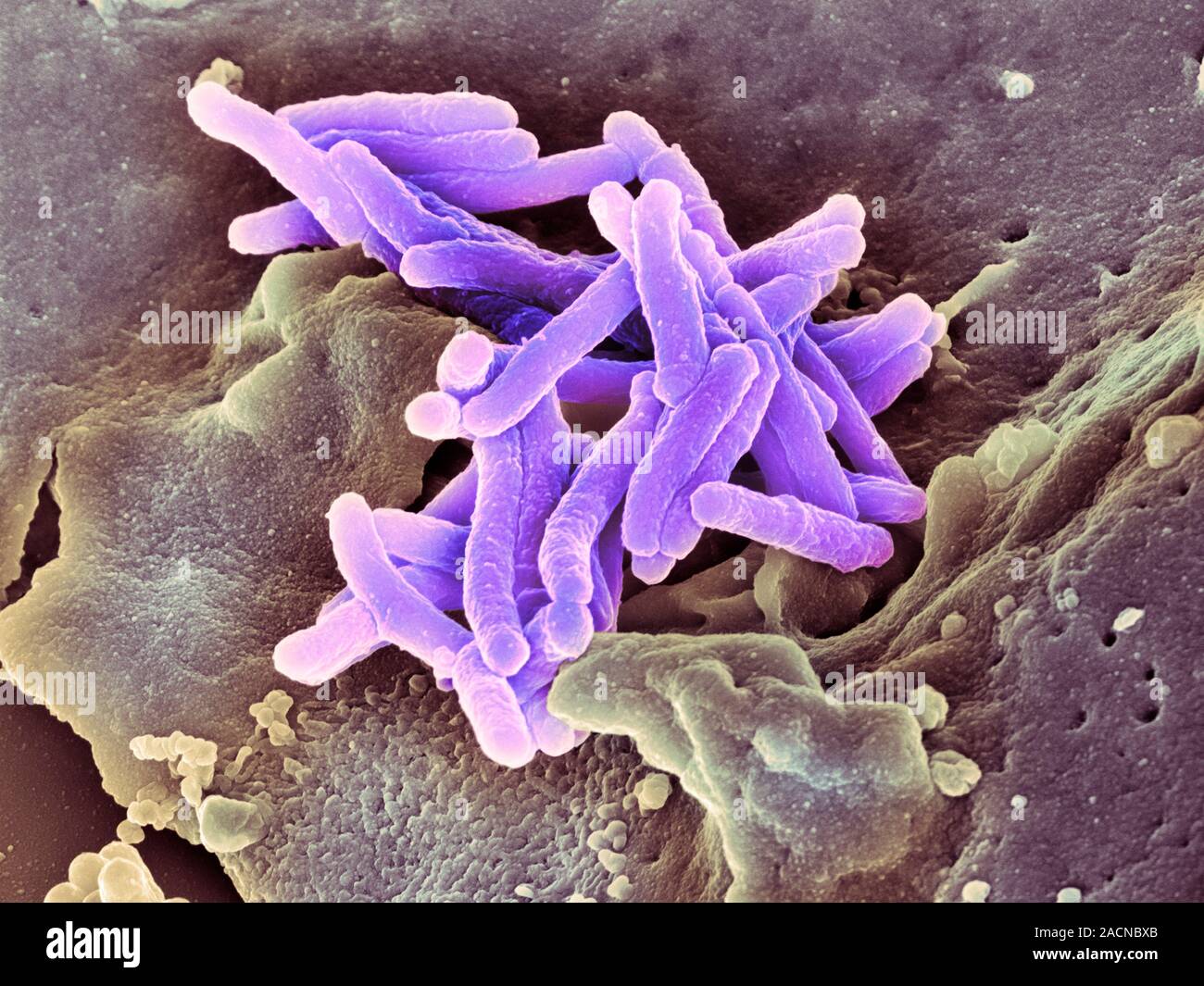 Macrophage engulfing TB bacteria. Coloured scanning electron micrograph (SEM) of a macrophage ...