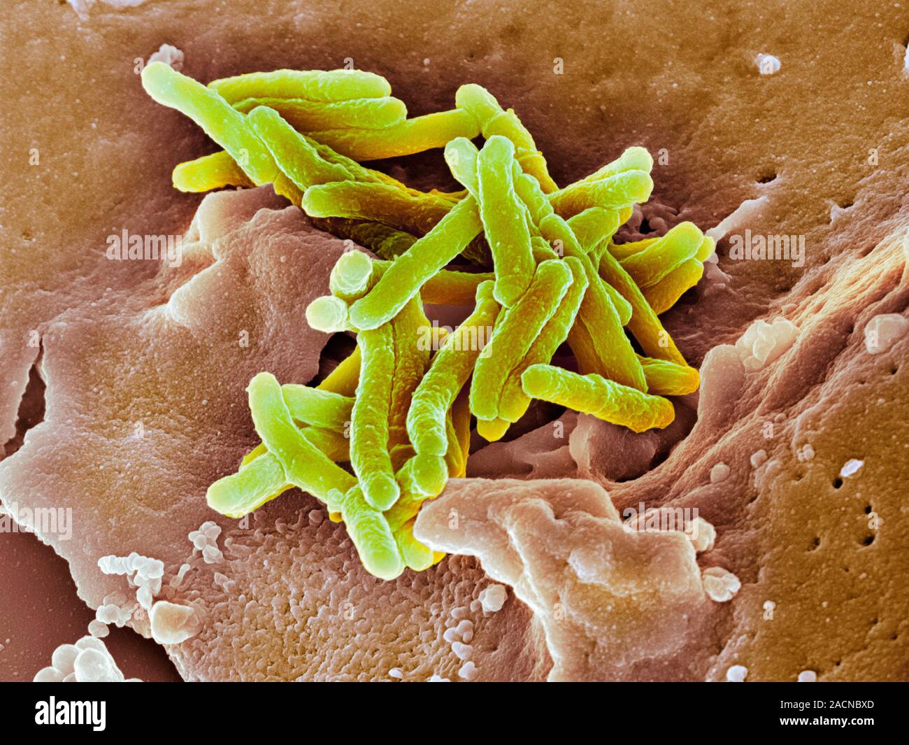 Macrophage engulfing TB bacteria. Coloured scanning electron micrograph (SEM) of a macrophage ...