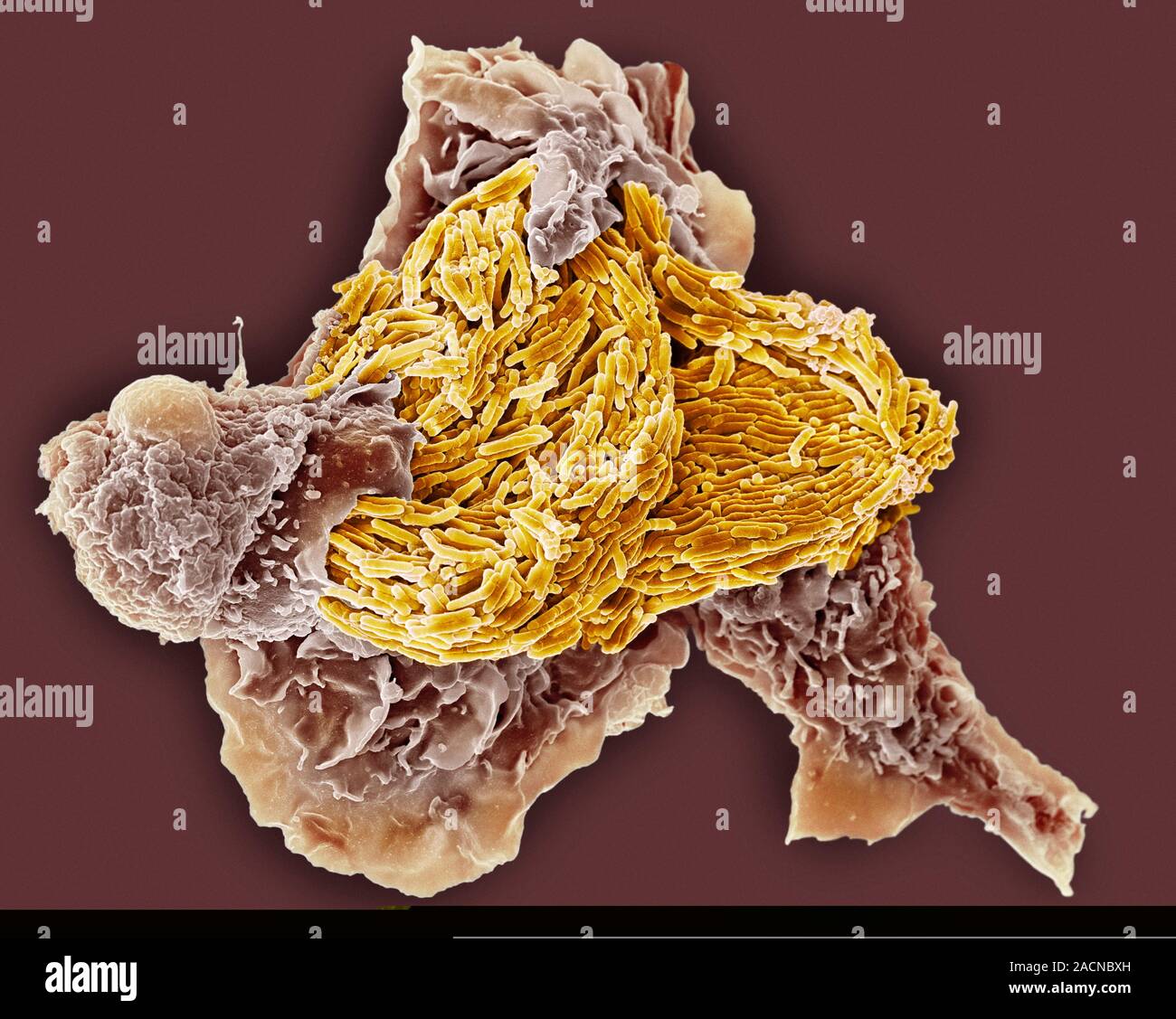 Macrophage engulfing TB bacteria. Coloured scanning electron micrograph ... Macrophage engulfing TB bacteria. Coloured scanning electron micrograph ...