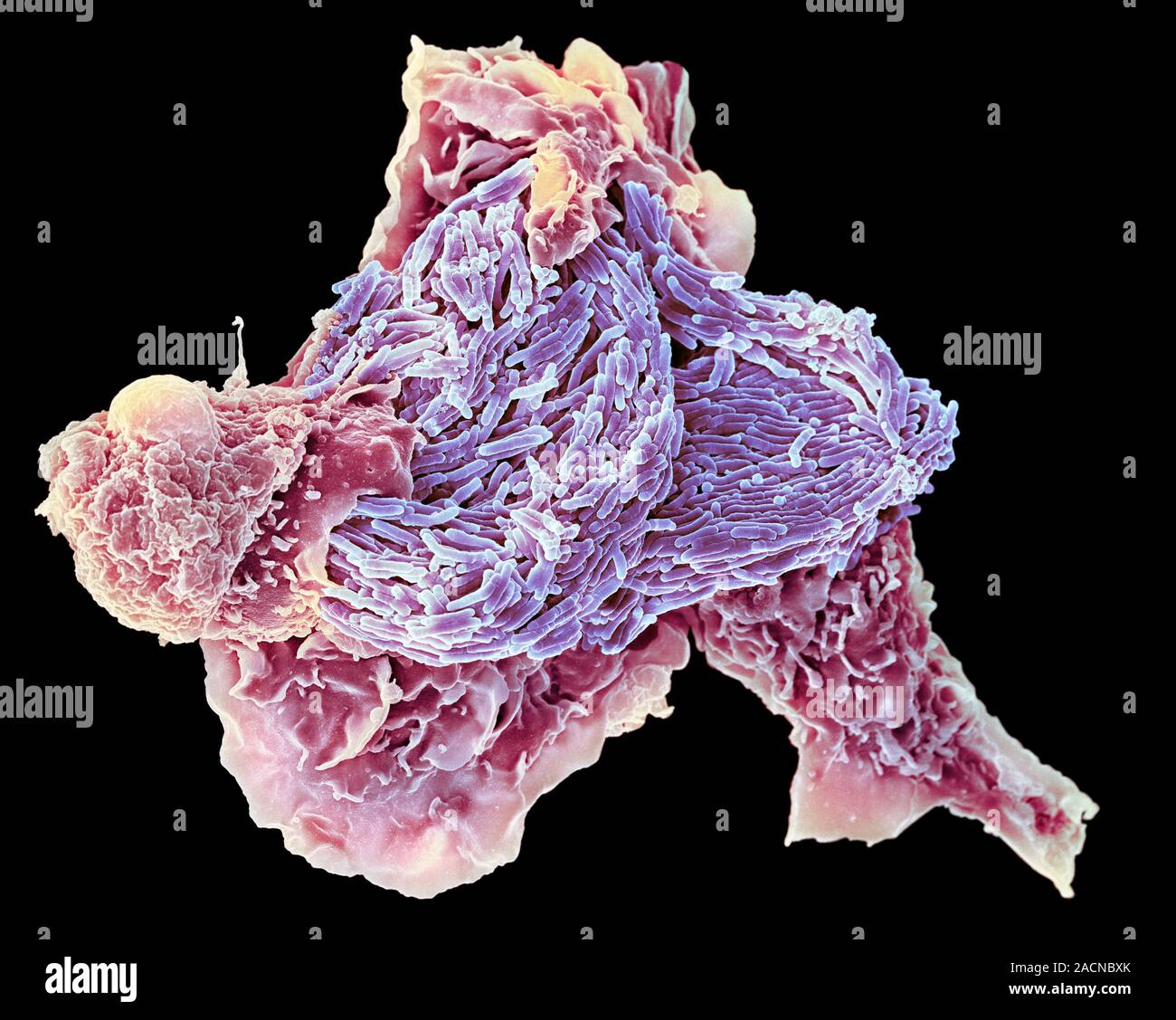 Macrophage engulfing TB bacteria. Coloured scanning electron micrograph (SEM) of a macrophage ...
