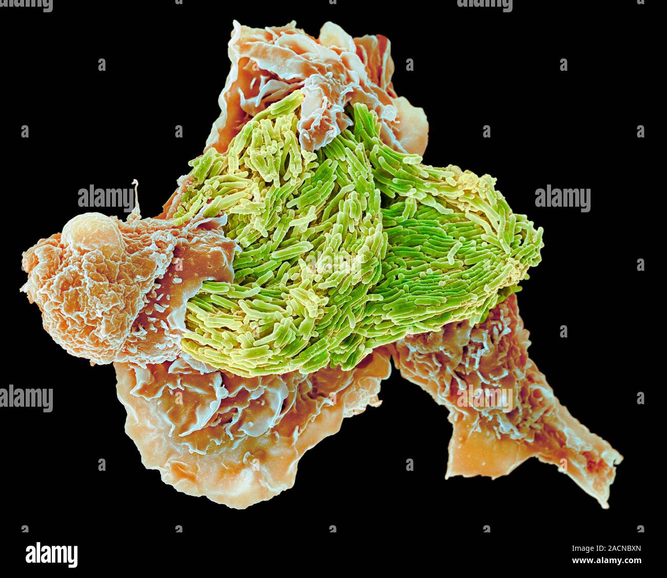 Macrophage engulfing TB bacteria. Coloured scanning electron micrograph (SEM) of a macrophage ...