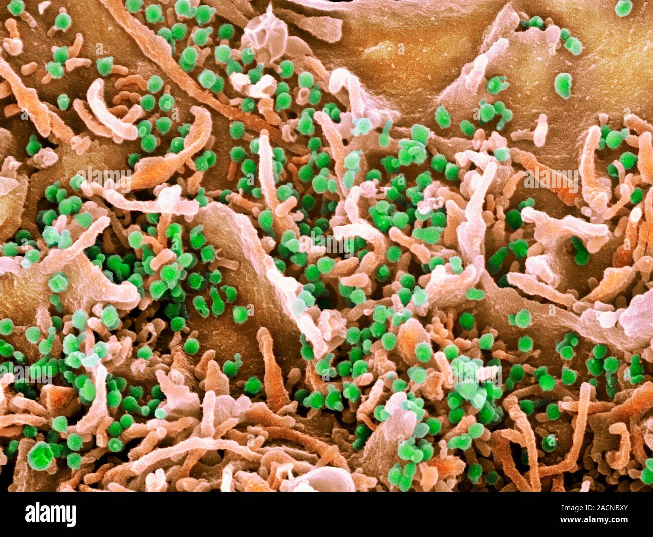 Cell infected with herpes virus. Coloured scanning electron micrograph ...