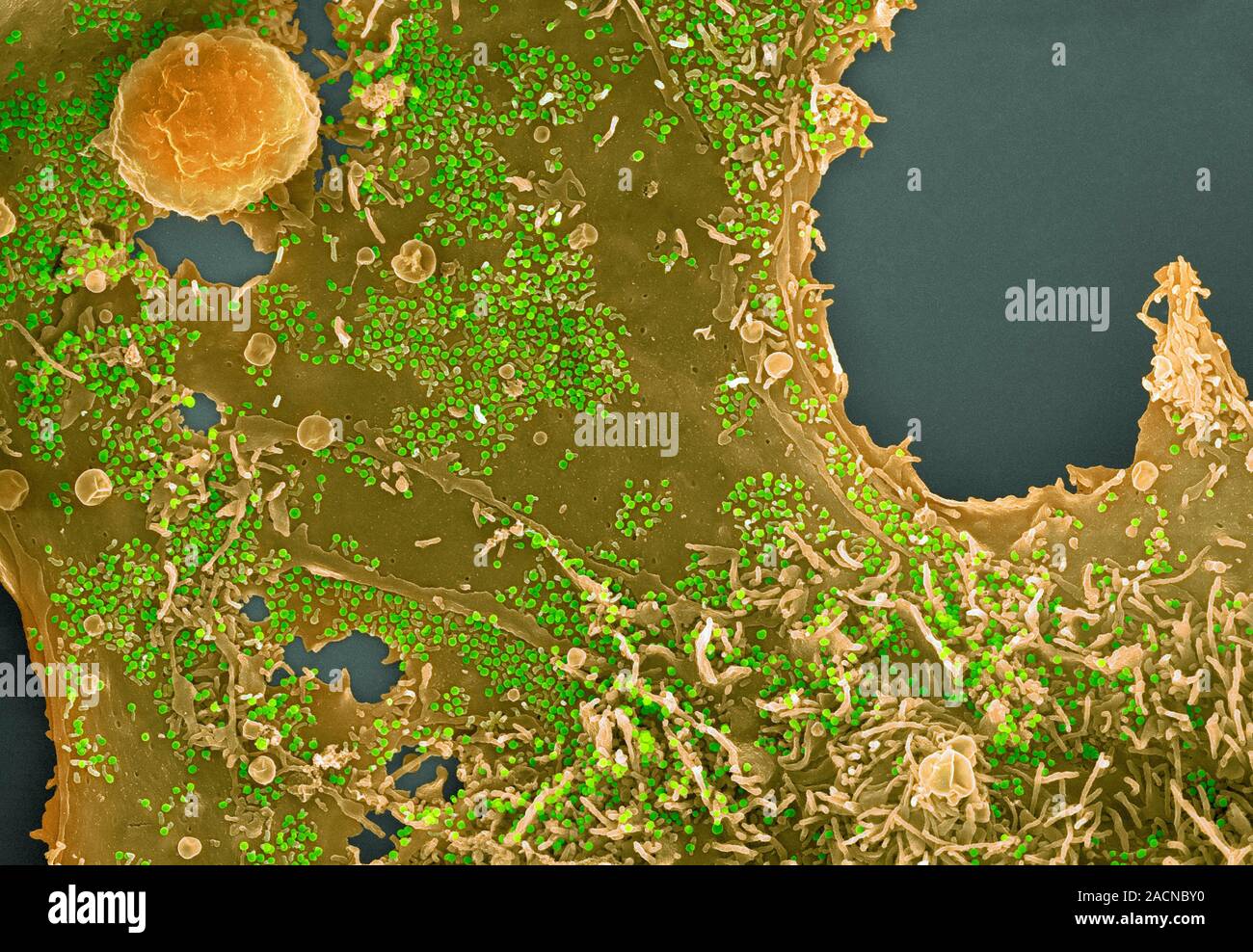 Cell infected with herpes virus. Coloured scanning electron micrograph ...