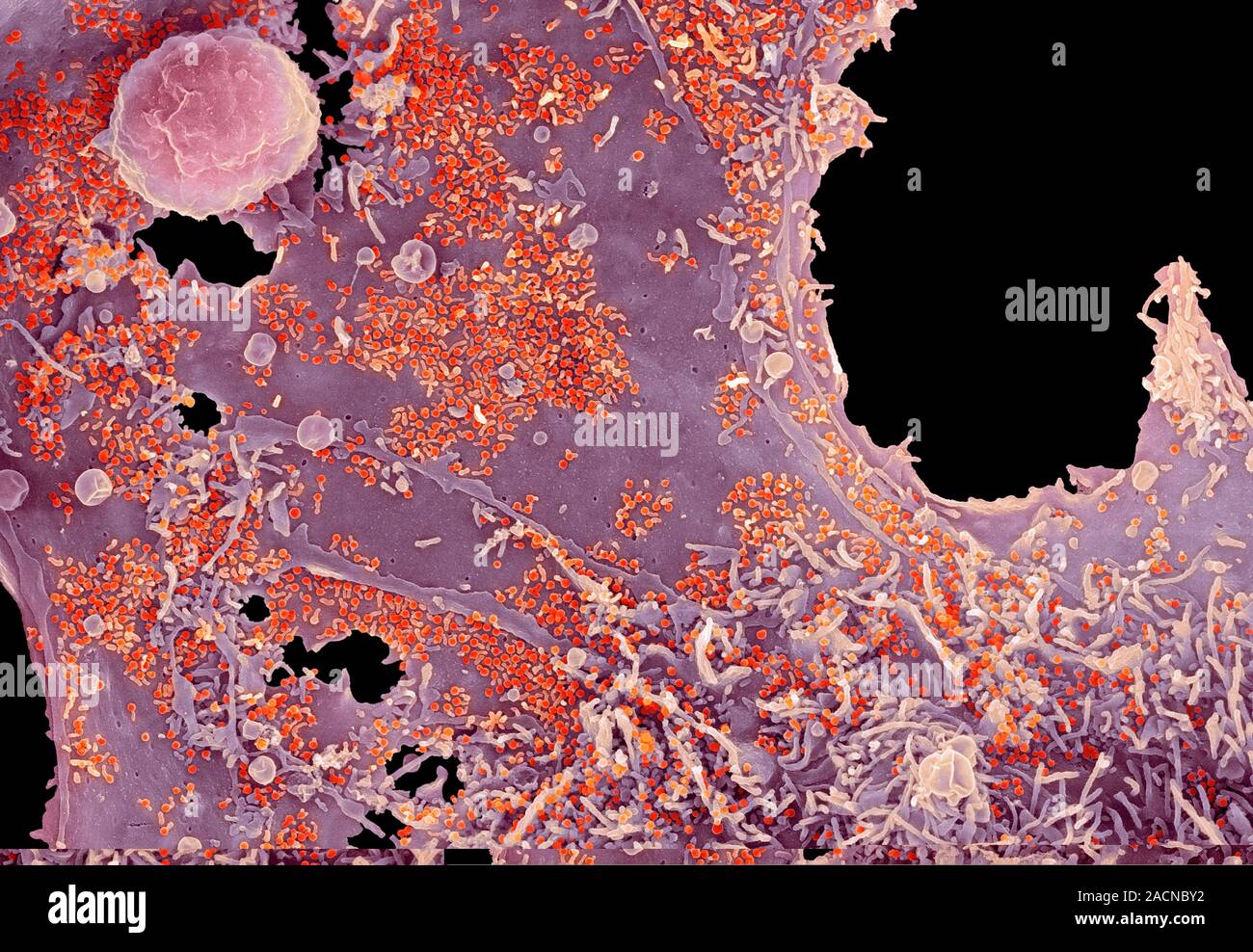 Cell infected with herpes virus. Coloured scanning electron micrograph ...