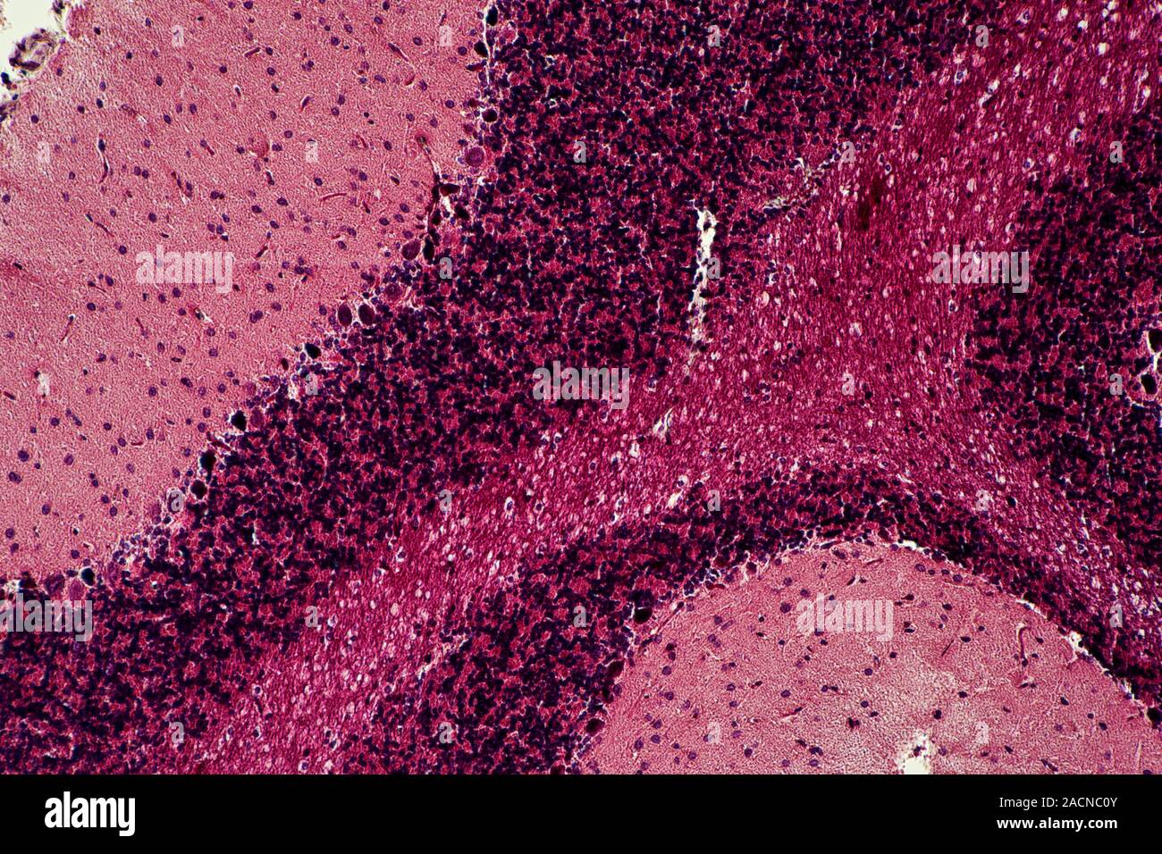 Cerebrum. Light micrograph of a section through part of the cerebrum of ...