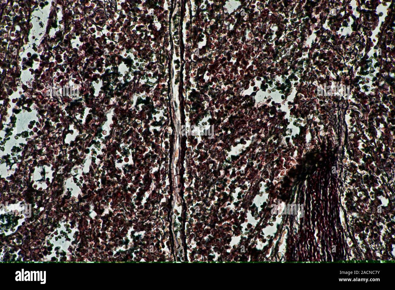 Spleen. Light micrograph of a section through the red pulp of a spleen ...