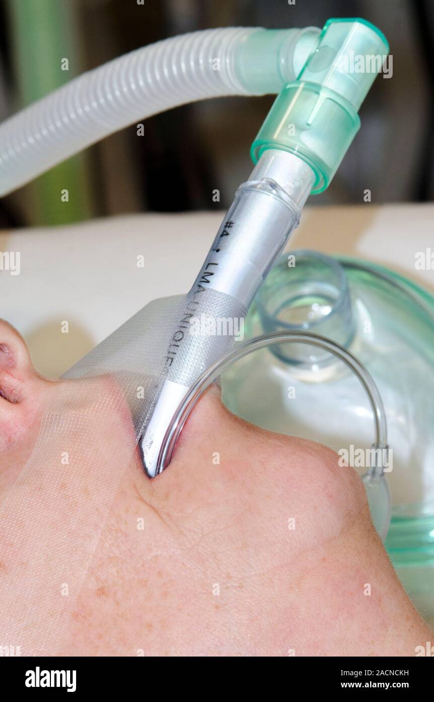 Intubated patient. 50-year-old female patient who has been intubated ...