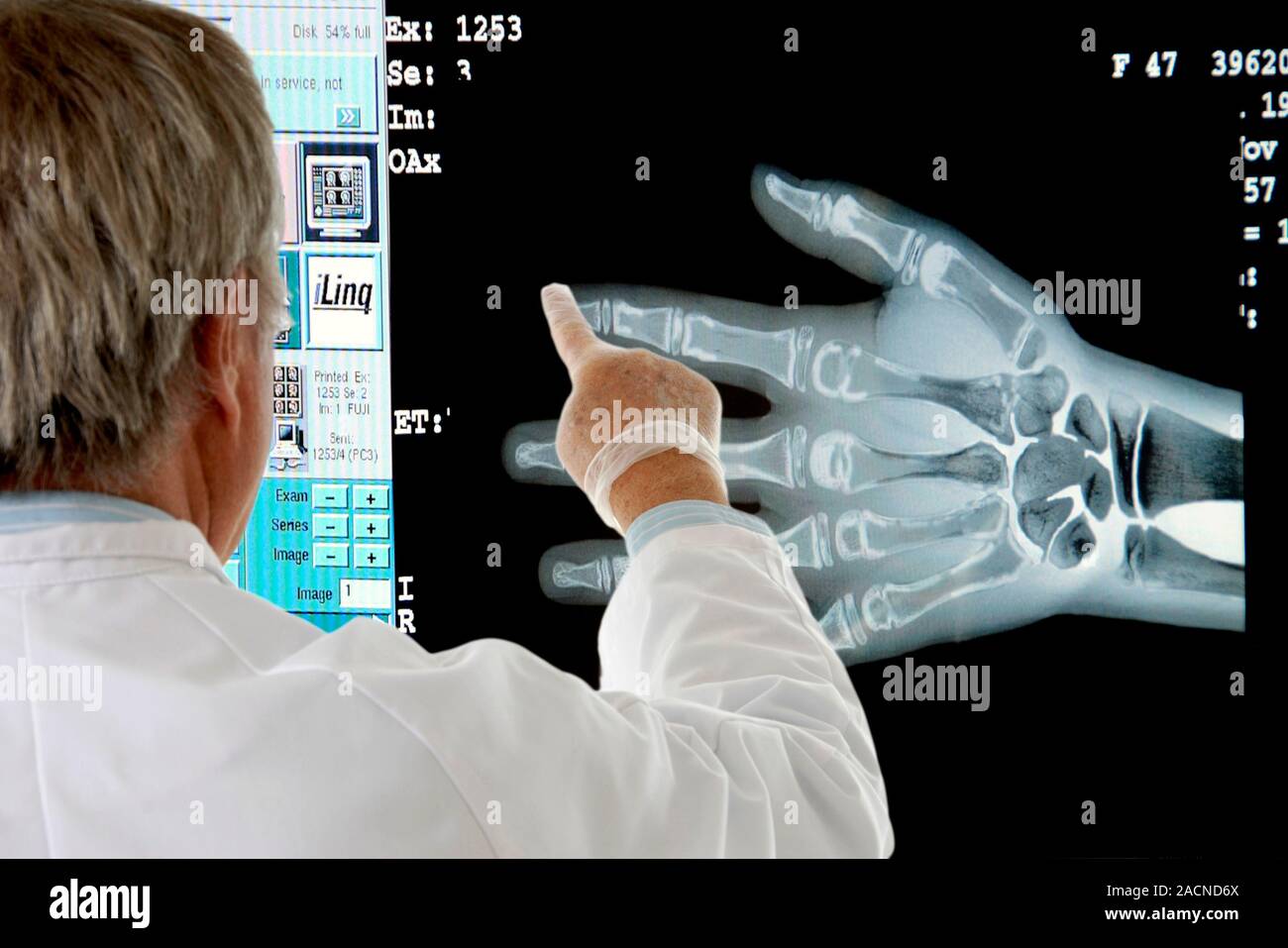 Radiologist examining a hand X-ray Stock Photo - Alamy
