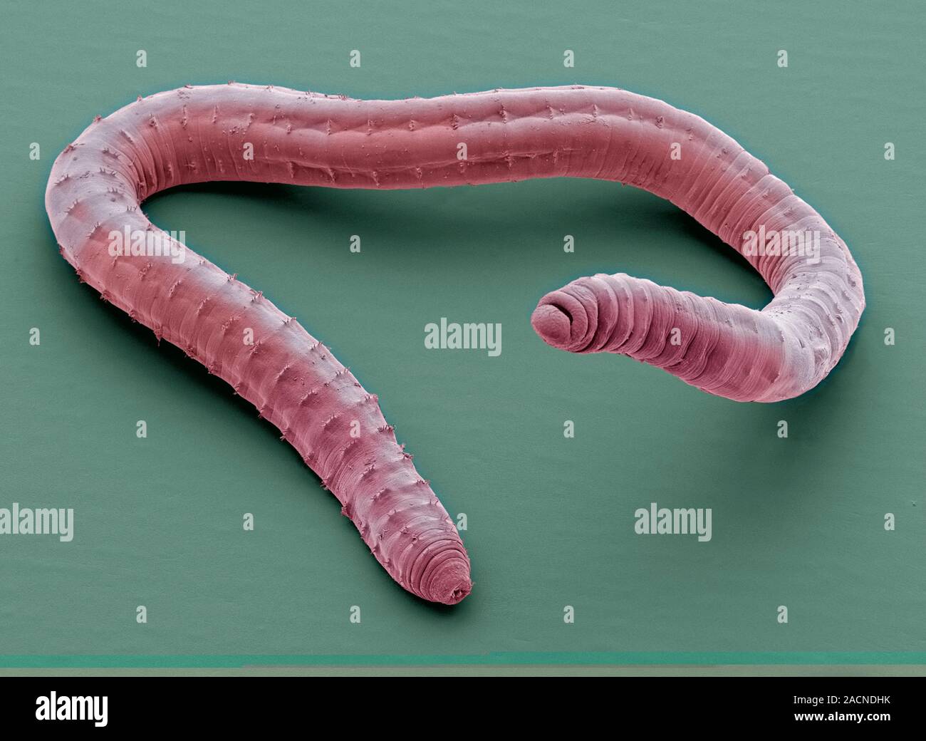 Annelid worm. Coloured scanning electron micrograph (SEM) of an annelid ...