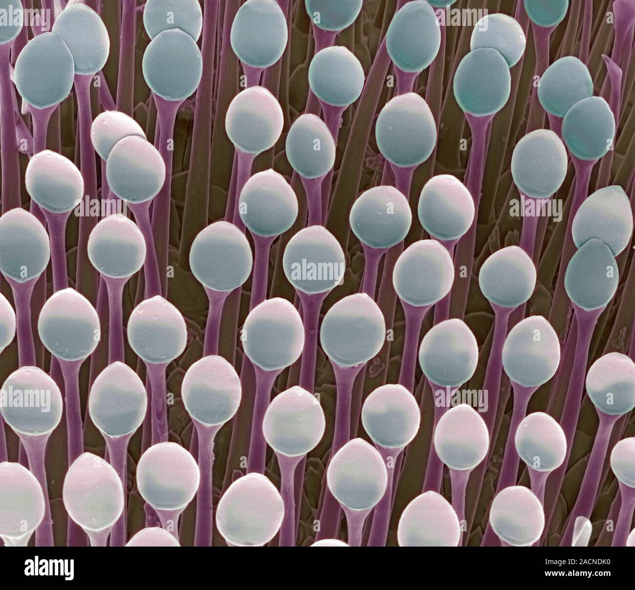 Ladybird foot hairs. Coloured scanning electron micrograph (SEM) of the ...