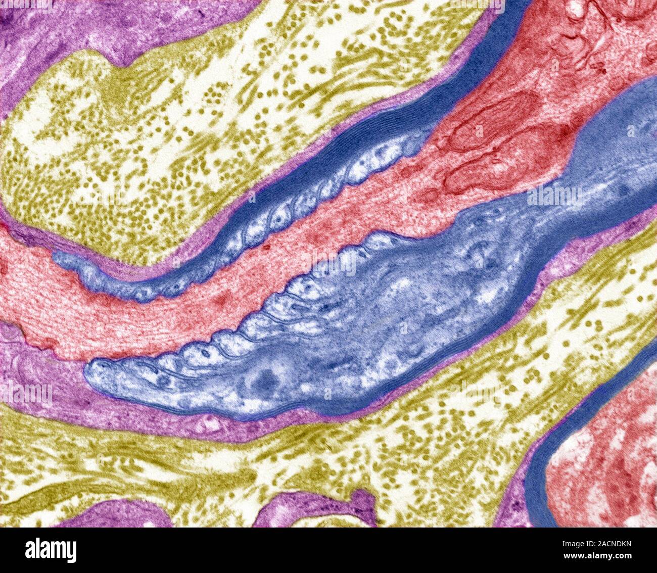 Nerve Fibre Node Transmission Electron Micrograph Tem Of A Longitudinal Section Through A