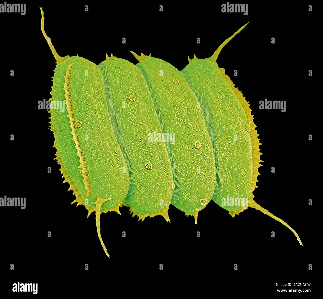 Scenedesmus algae. Coloured scanning electron micrograph (SEM) of ...