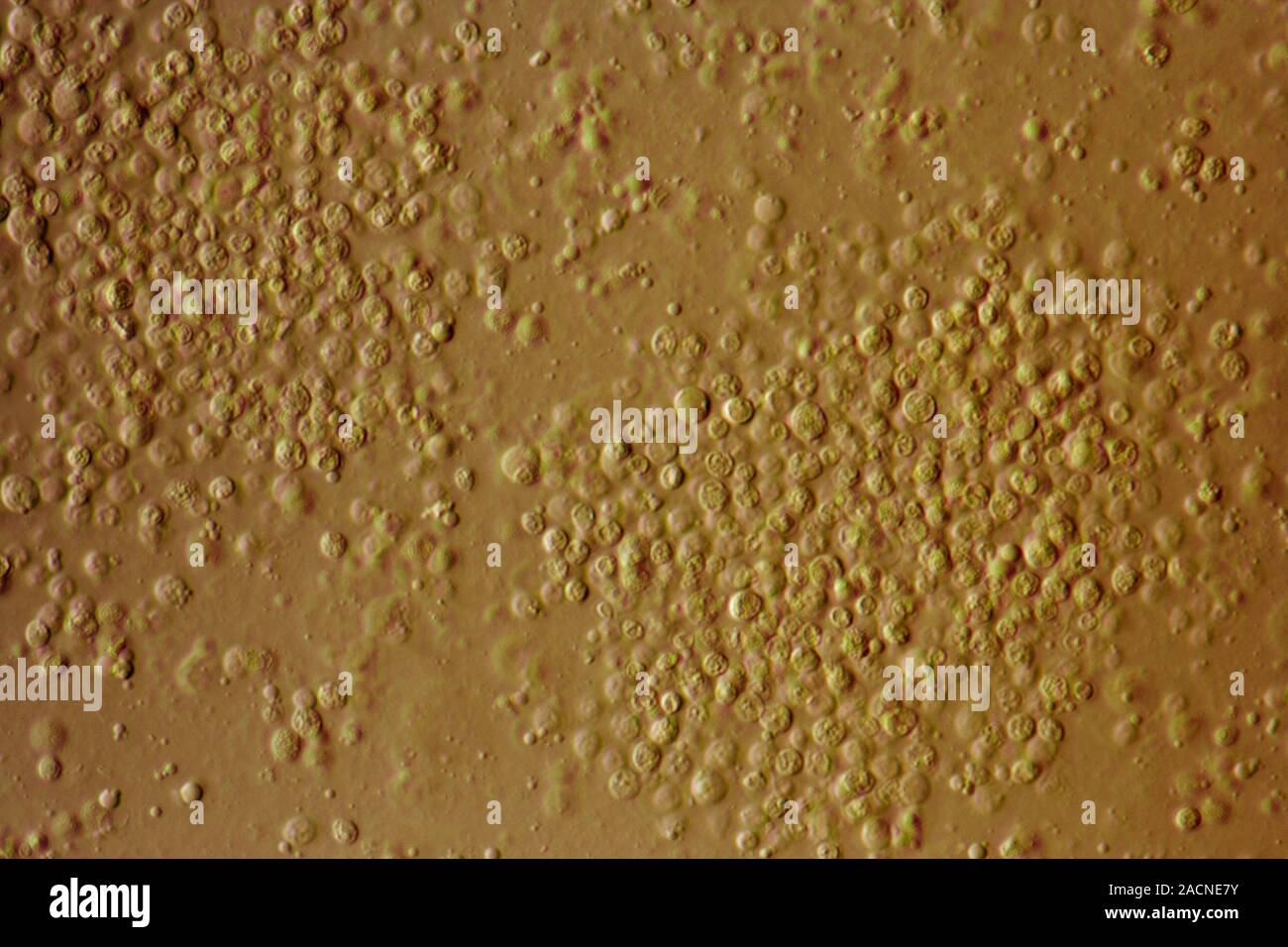 Fermented ginger beer. Light micrograph of fermented ginger beer under ...