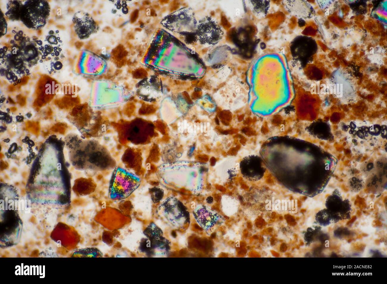 Belgian chocolate drink composition. Light Micrograph of a chocolate ...