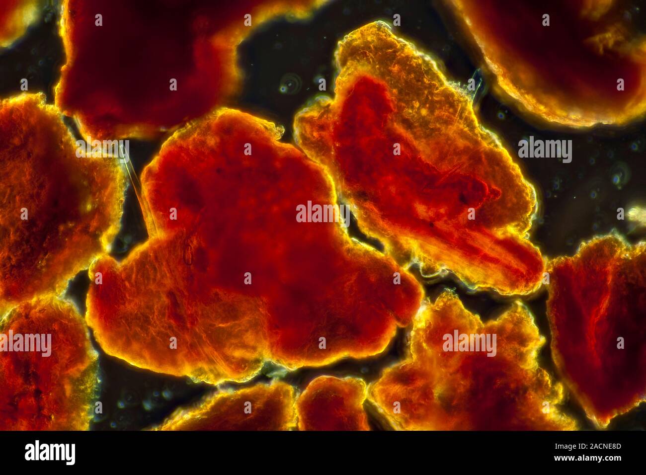 Tea Leaves. Light Micrograph of tea leaf fragments after infusion ...