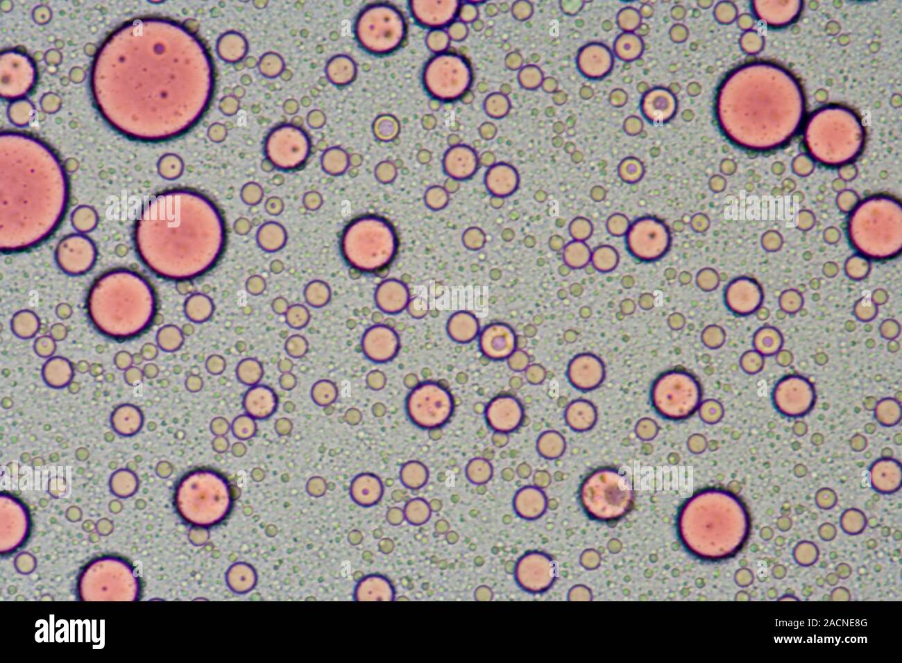 Fat Globules in Milk. Light Micrograph of fat globules (stained pink ...