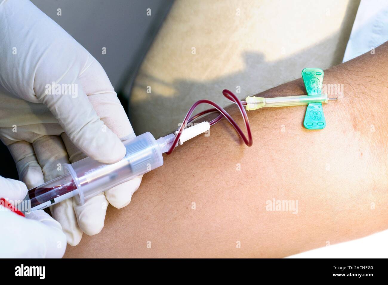 Blood sampling, tuberculosis (TB) test. Close-up of a blood sample ...