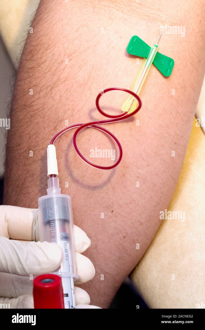 Blood sampling, tuberculosis (TB) test. Close-up of a blood sample ...