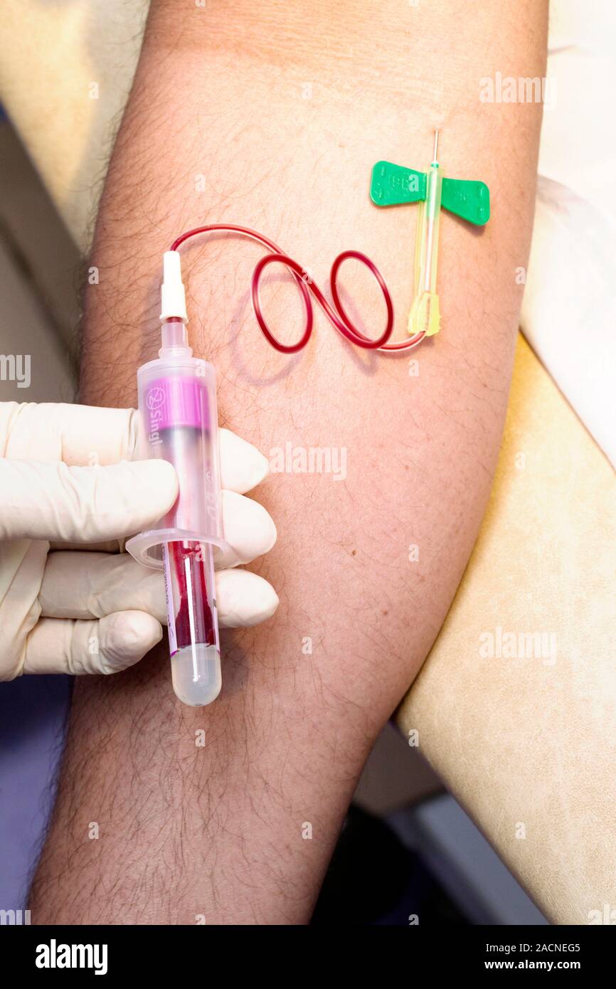Blood sampling, tuberculosis (TB) test. Close-up of a blood sample ...