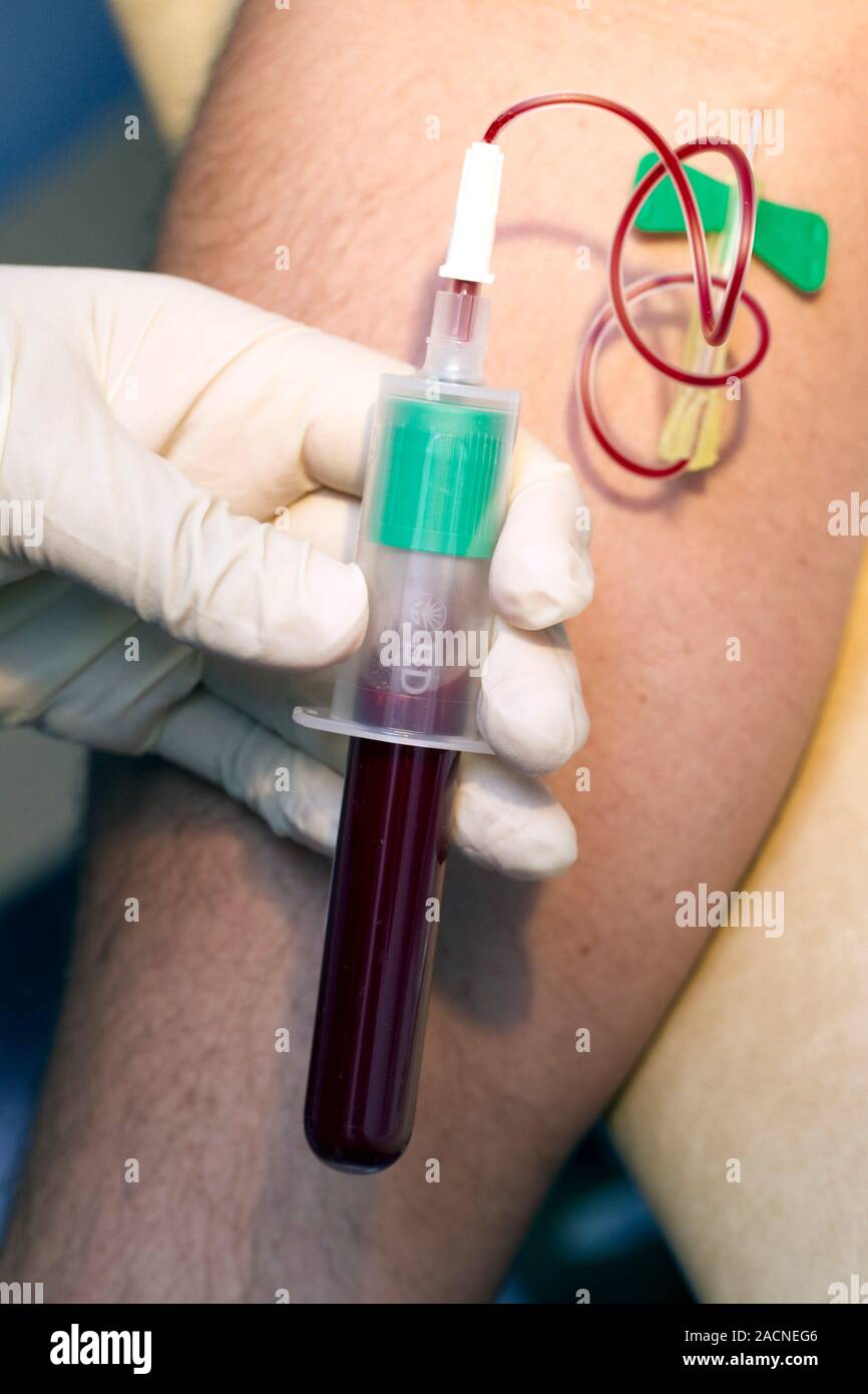 Blood sampling, tuberculosis (TB) test. Close-up of a blood sample ...