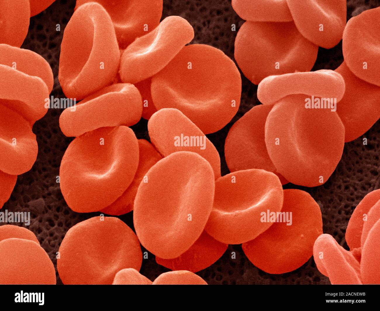 Red blood cells. Coloured scanning electron micrograph (SEM) of red ...