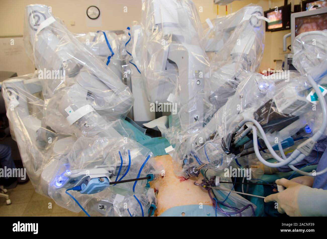 Robotic prostate cancer surgery. Surgeon using a Da Vinci robot surgeon ...