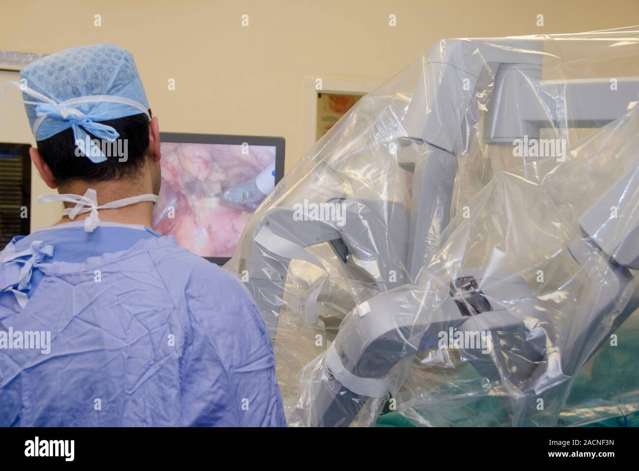 Robotic prostate cancer surgery. Surgeon using a Da Vinci robot surgeon ...