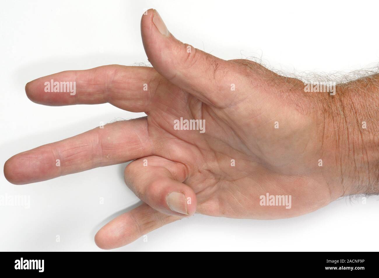Not for use in Television Not for use in Television Flexion (bending ...