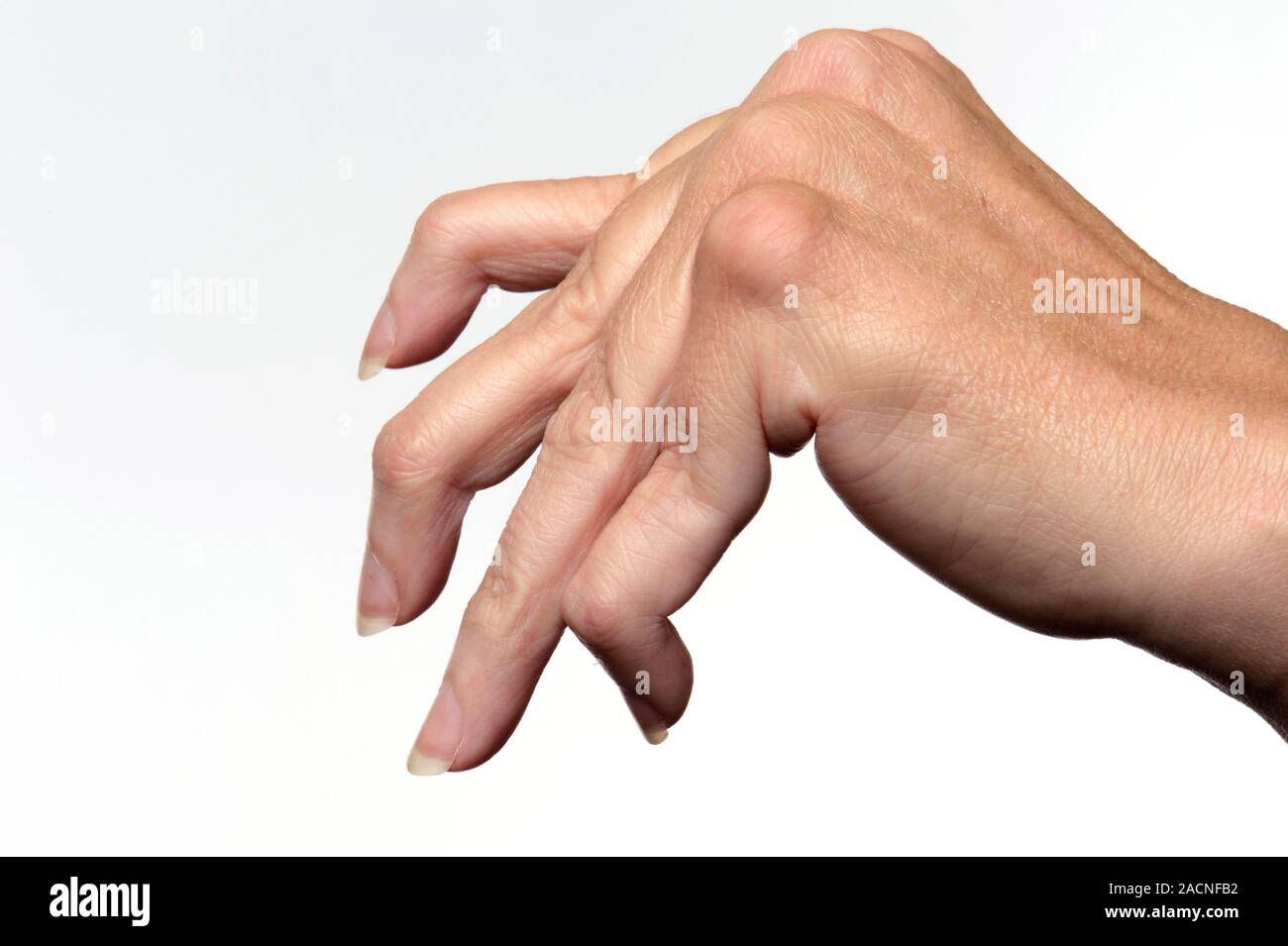 Not for use in Television Not for use in Television Close-up of ...