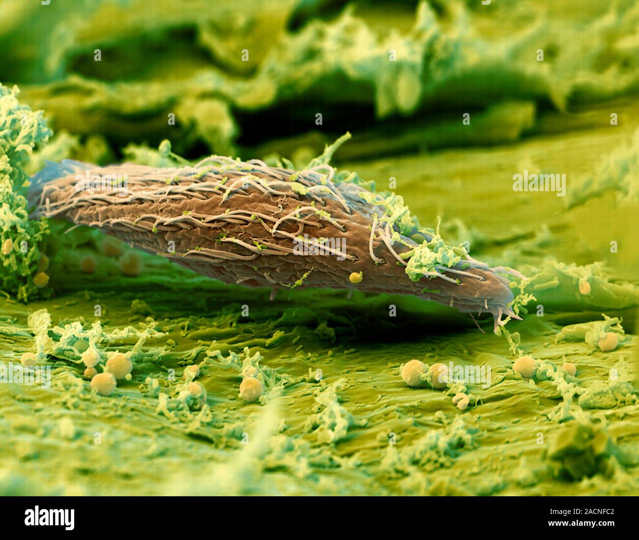 Ciliate protozoan, coloured scanning electron micrograph (SEM). This ...
