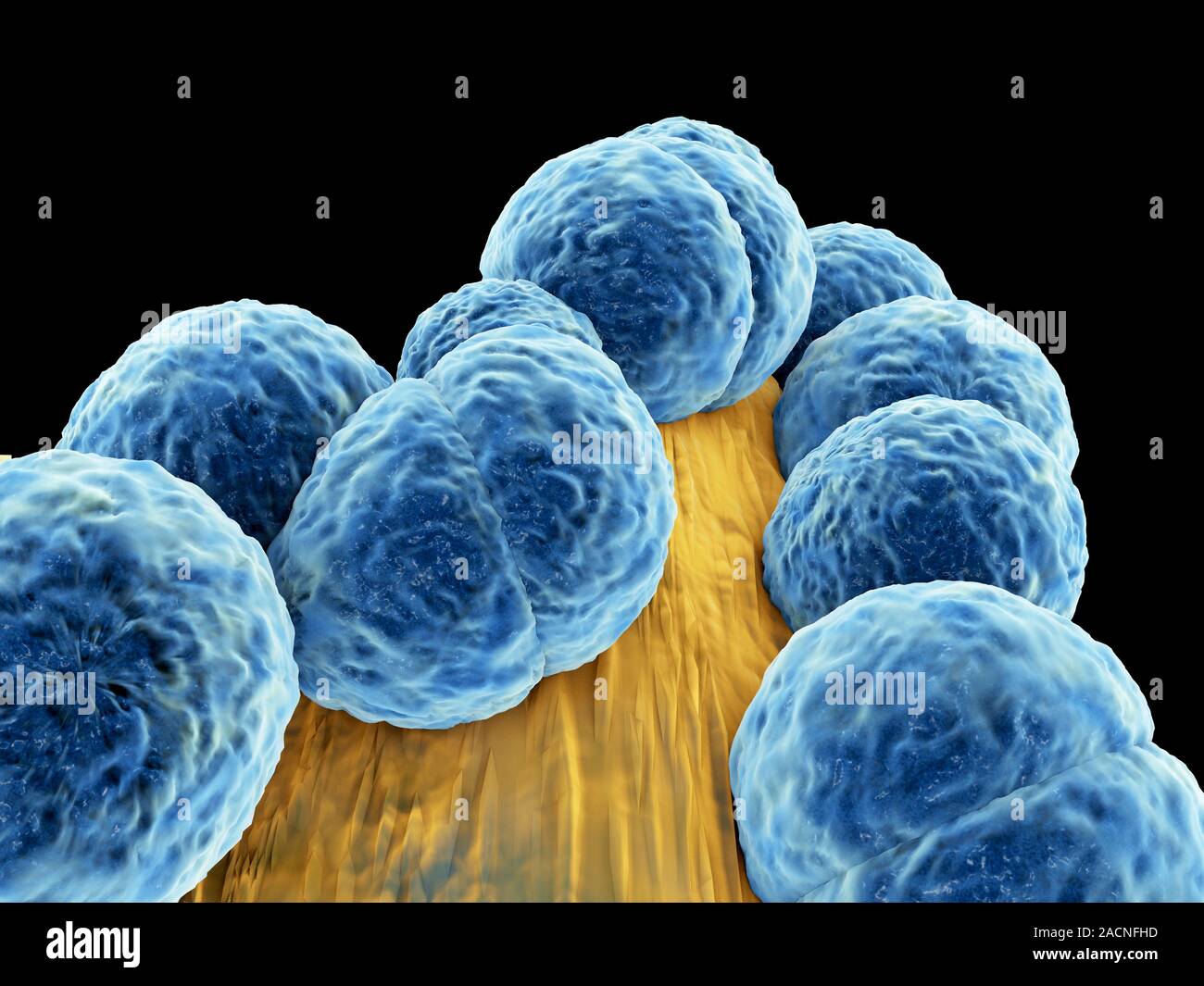 Staphylococcus aureus MRSA bacteria, computer artwork. Methicillin ...