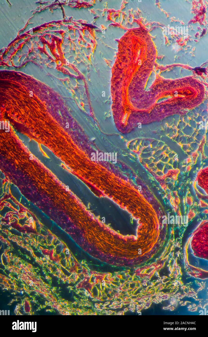 Blood vessels. Light micrograph of a section through healthy human ...