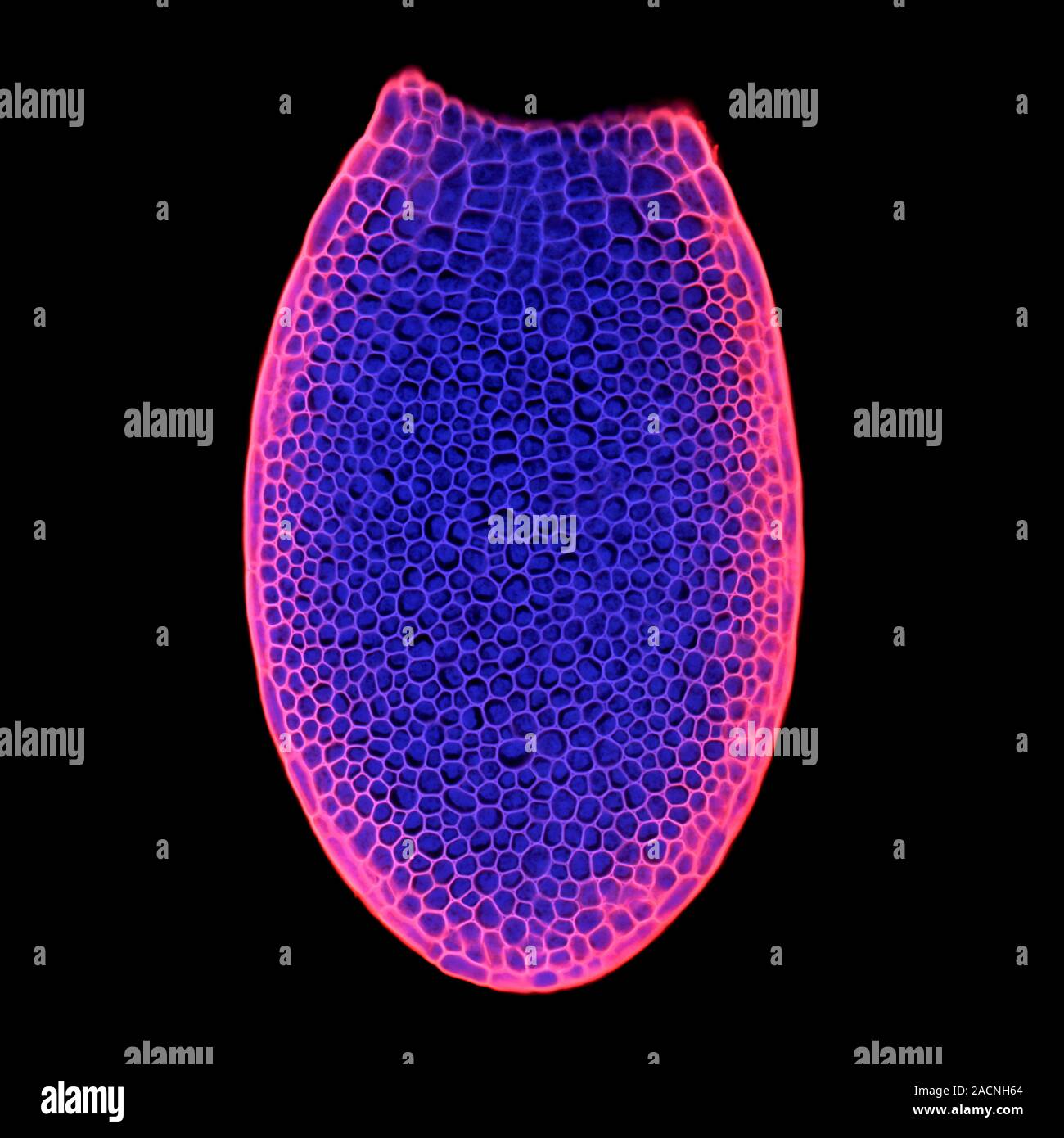 Arabidopsis thaliana embryo. Confocal light micrograph of a section ...