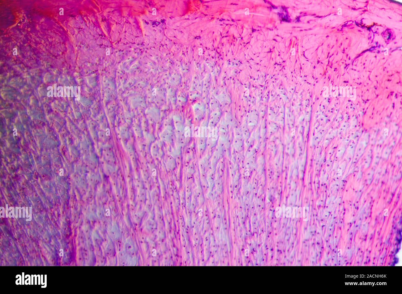 Muscle tissue. Light micrograph of a section through fibrous connective ...