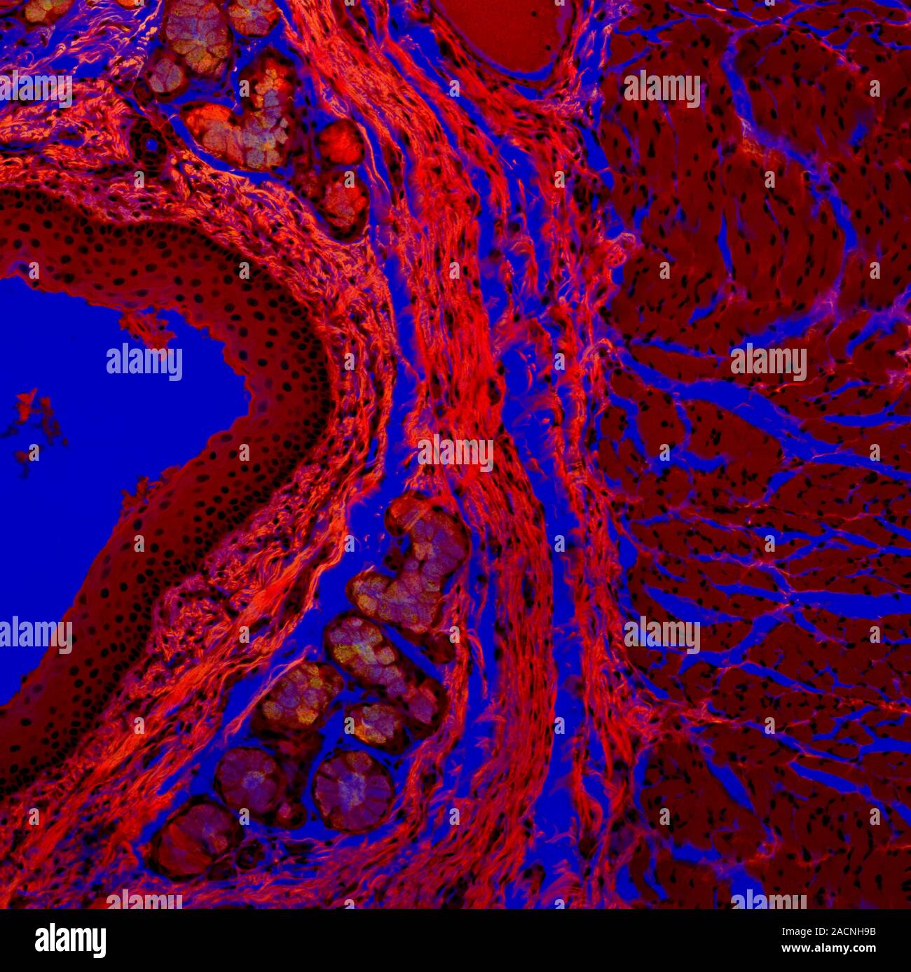 Squamous epithelium. Laser scanning confocal micrograph (LSCM) of a ...