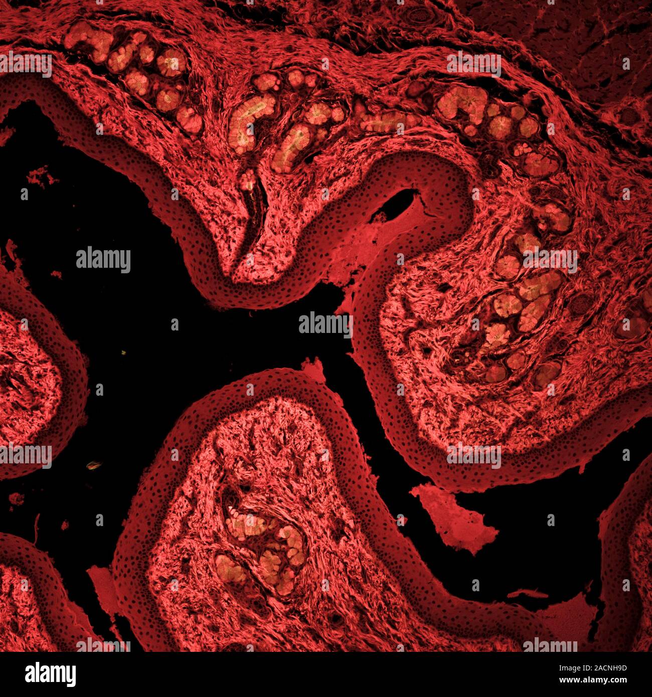 Squamous epithelium. Laser scanning confocal micrograph (LSCM) of a ...