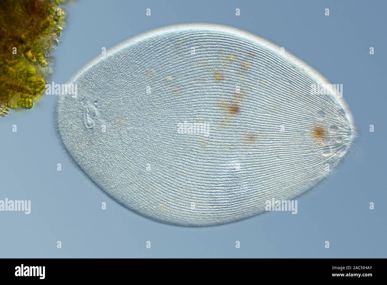 Ciliate protozoan. Differential interference contrast micrograph of a ...