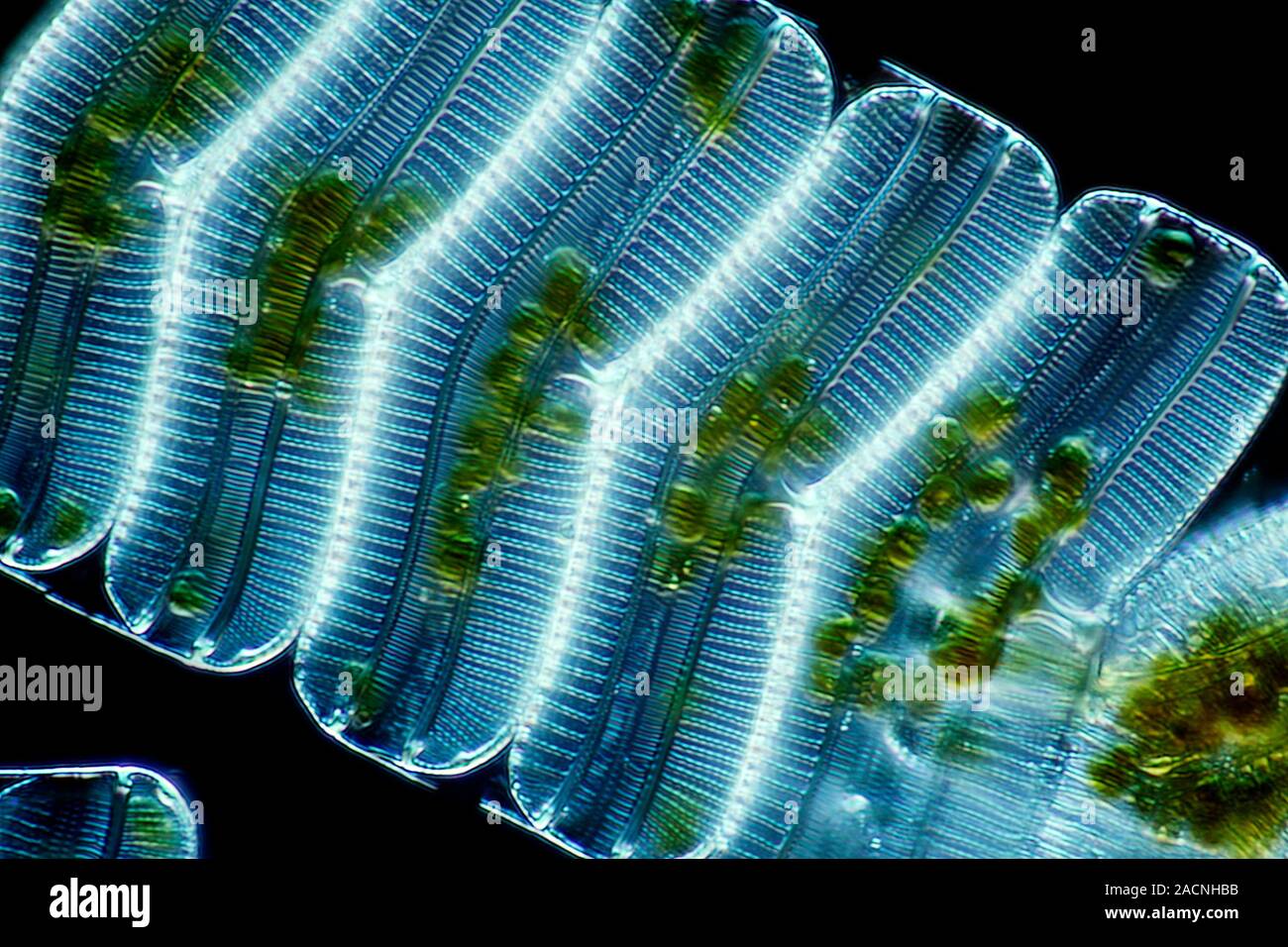 Diatoms. Differential interference contrast micrograph of a group of ...