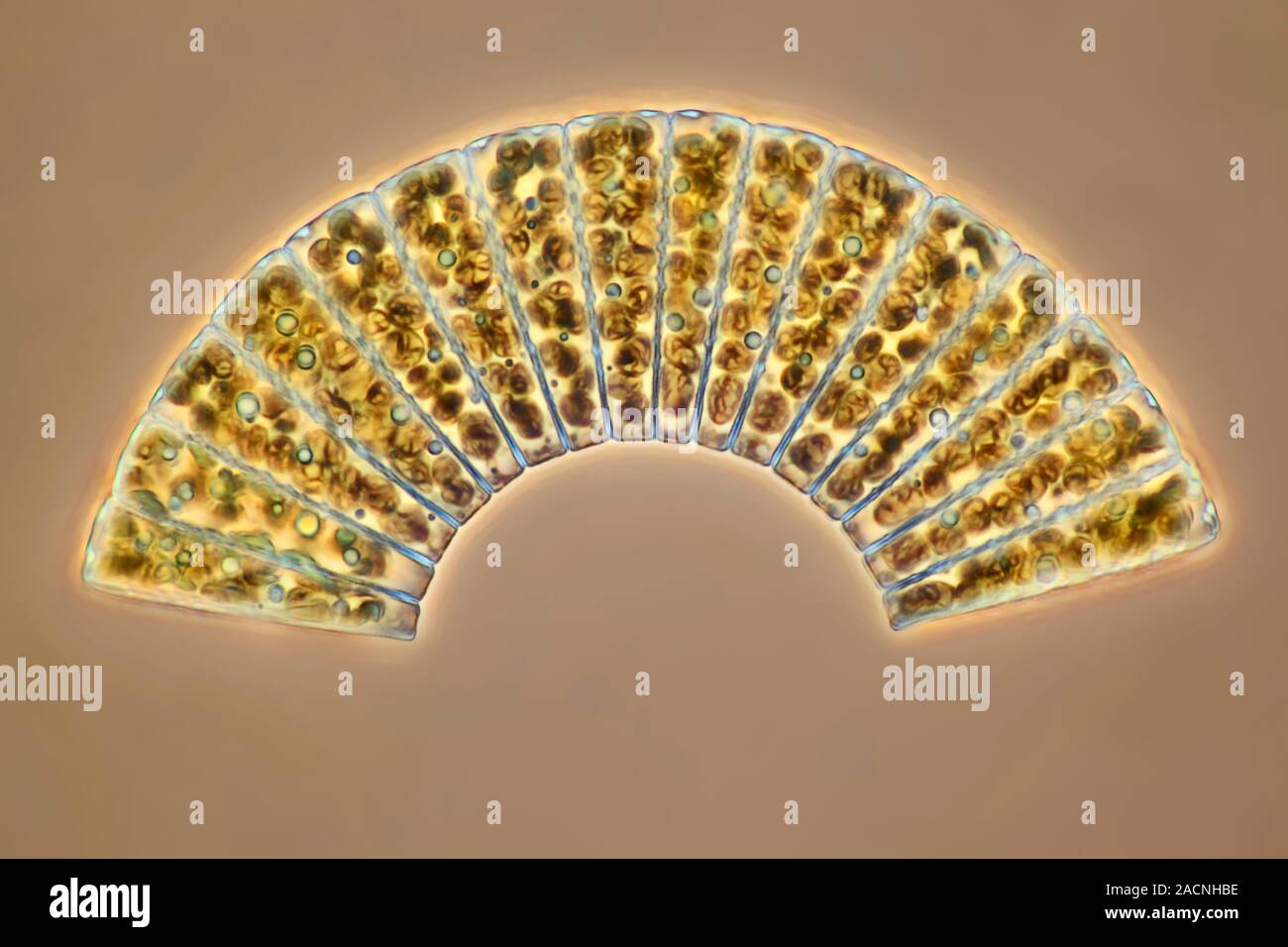 Diatoms. Differential interference contrast micrograph of a group of ...
