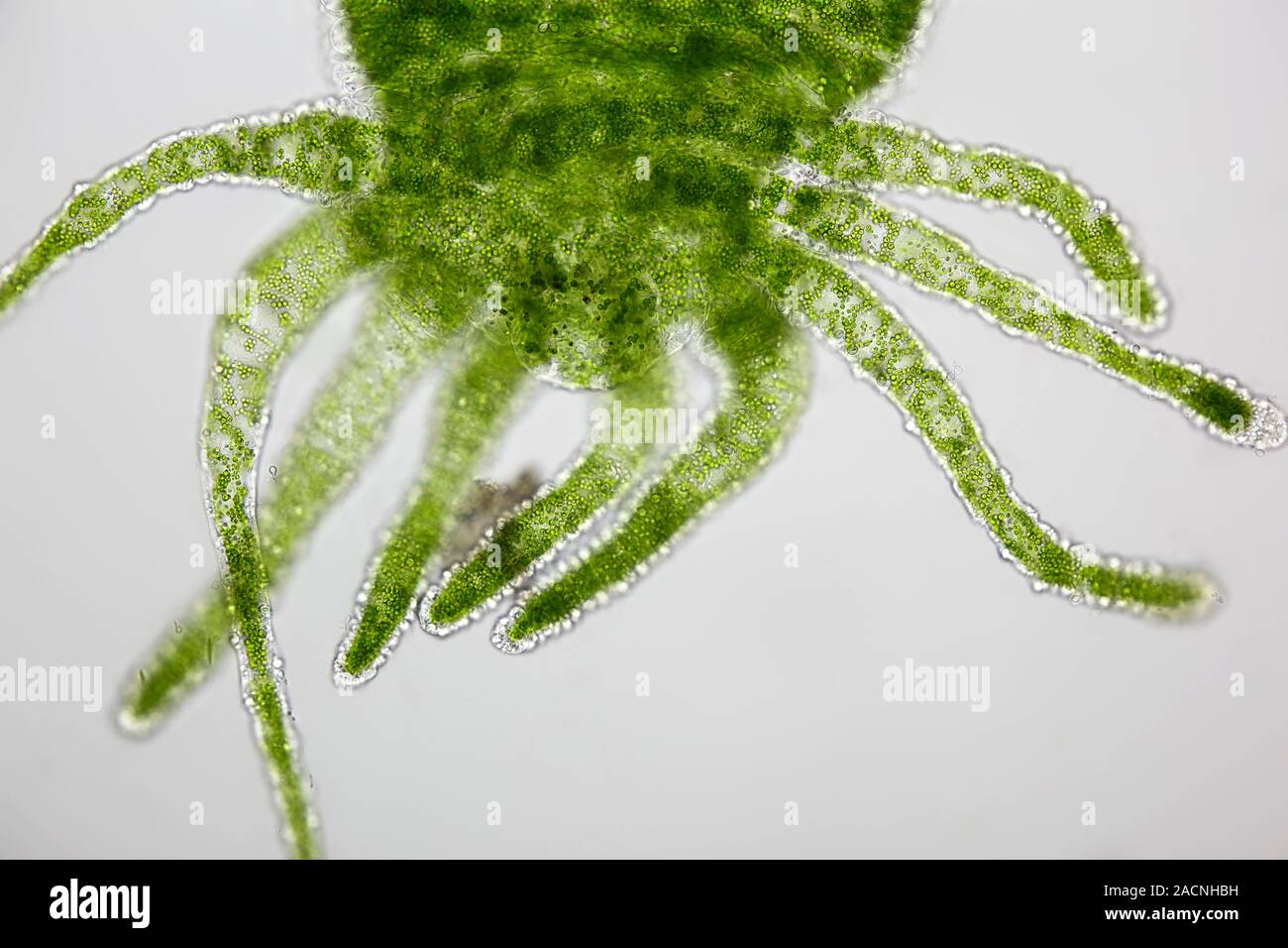 Green hydra. Light micrograph of the tentacled head of a green hydra ...