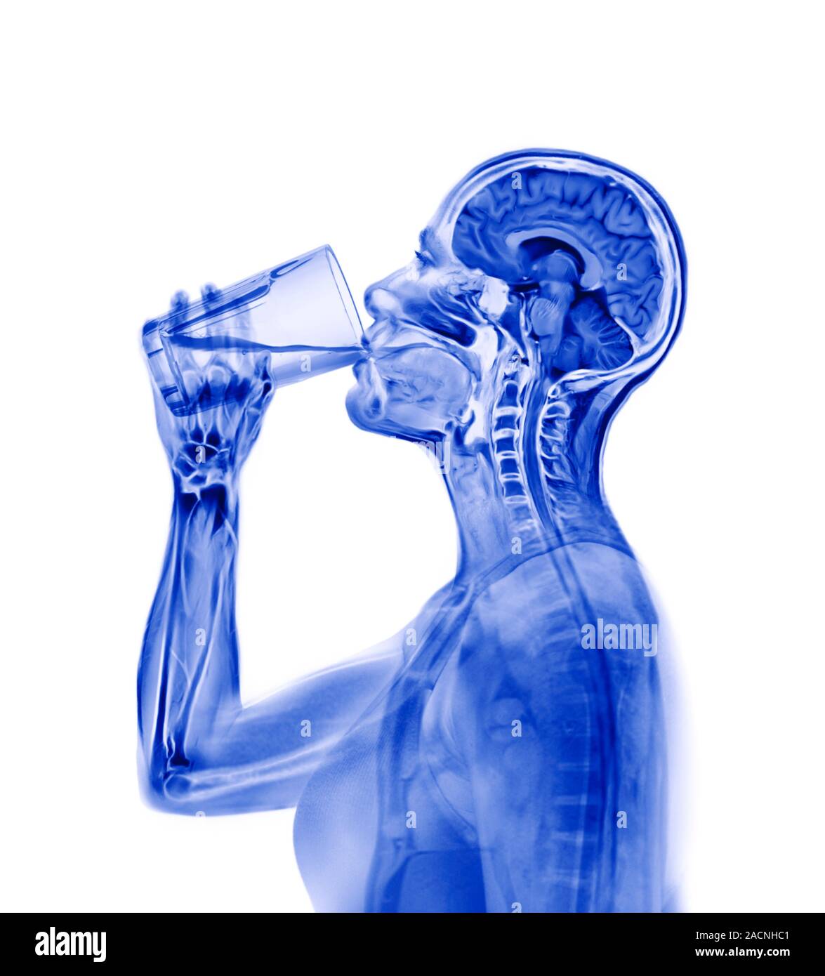 Woman drinking. Digitally enhanced composite X-ray and MRI (magnetic ...
