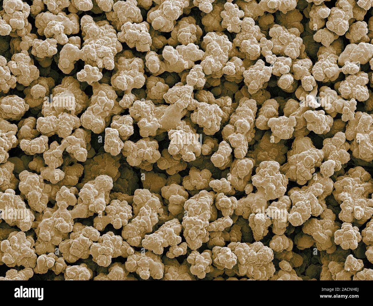 Nucleic acid isolation resin. Coloured scanning electron micrograph ...