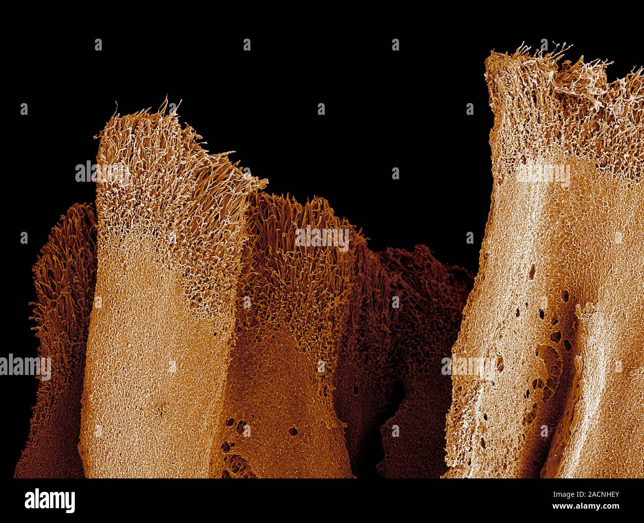 Lichen Coloured Scanning Electron Micrograph Sem Showing The Structure Of A Lichen Lichens